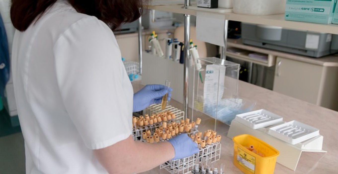 Enolasi neurone specifica – NSE marker - Laboratorio Dr. D'Errico Angelo